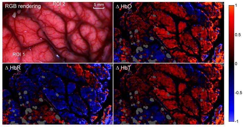 Medical Hyperspectral Imaging For Surgery And Diagnostics Imec